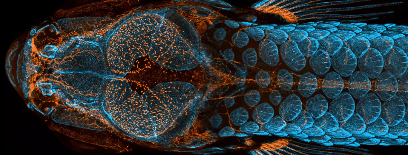 En Zebrafësch stéiert an de Gewënner vum 2020 Nikon Small World Mikrofotografie Concours