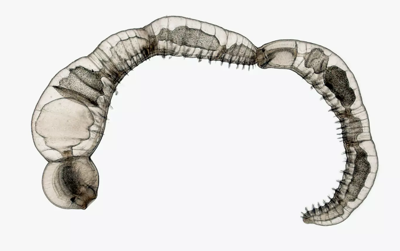 15 Chaetogaster Zooid දාමය