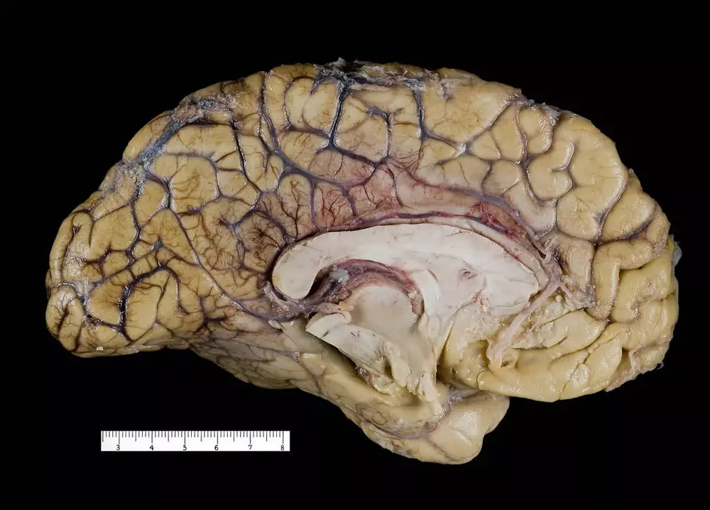 Medical Photography Human Brain Seksje